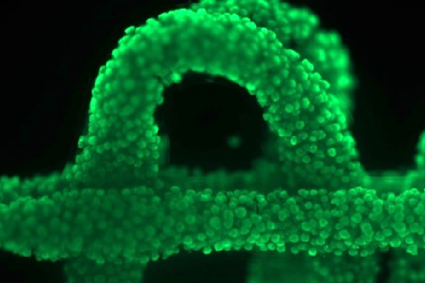 Pipeline of Bioprinted Tissue Therapeutics | Aspect Biosystems